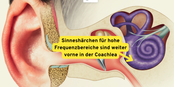 Audiogramme lesen und Hörkurven auswerten - Echo