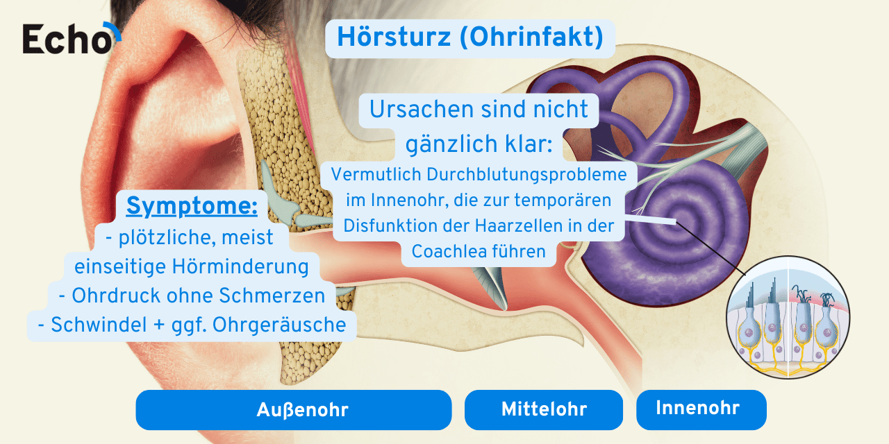 13 häufigste Ohrenerkrankungen👂🏼 [Ursachen, Symptome & Tipps] - Echo