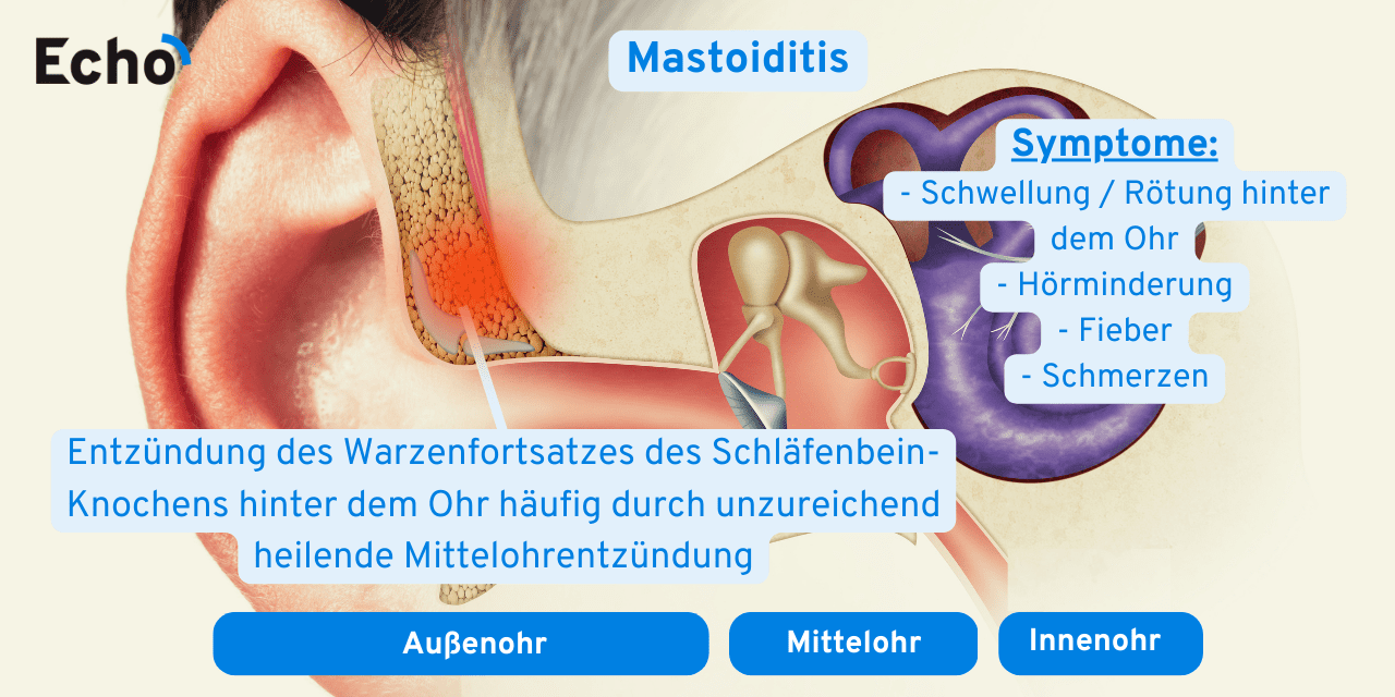 13 häufigste Ohrenerkrankungen👂🏼 [Ursachen, Symptome & Tipps] - Echo