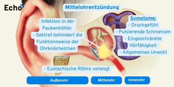 13 häufigste Ohrenerkrankungen👂🏼 [Ursachen, Symptome & Tipps] - Echo