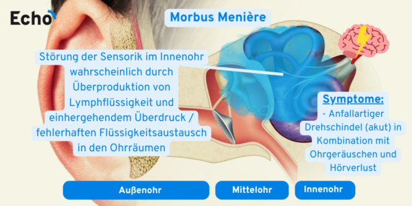 13 häufigste Ohrenerkrankungen👂🏼 [Ursachen, Symptome & Tipps] - Echo