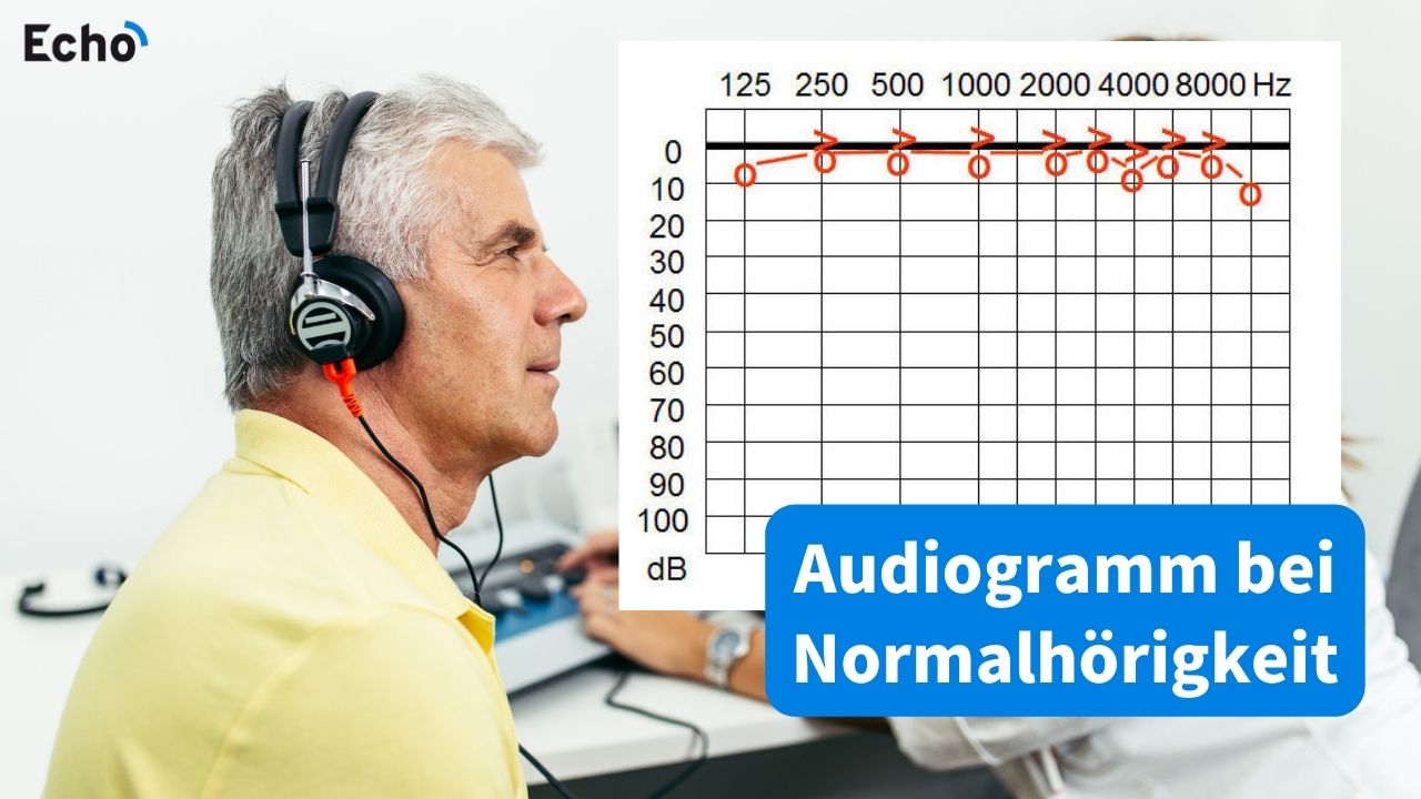 Audiogramme lesen und Hörkurven auswerten - Echo