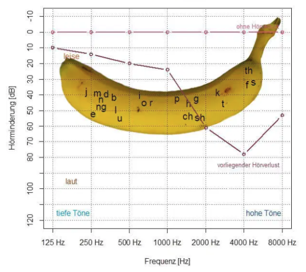 Audiogramme lesen 🤓📉 Das 1x1 der Hörkurven-Auswertung - Echo