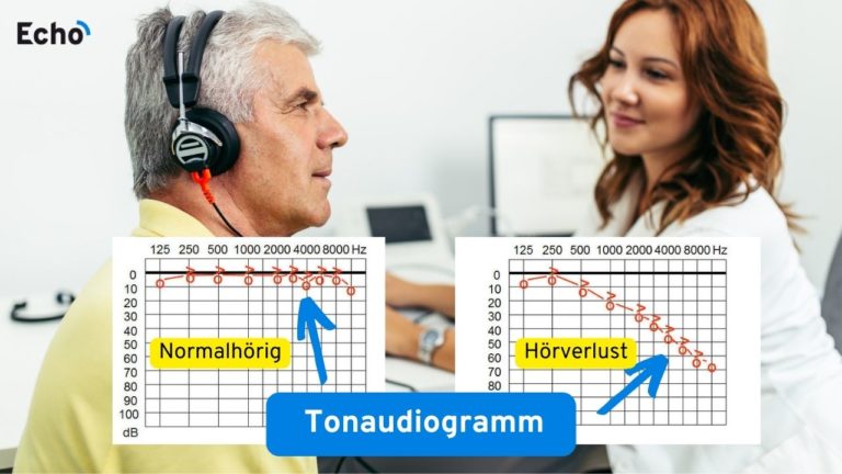 So funktioniert ein Hörgerät • einfach erklärt [mit Aufbau] - Echo